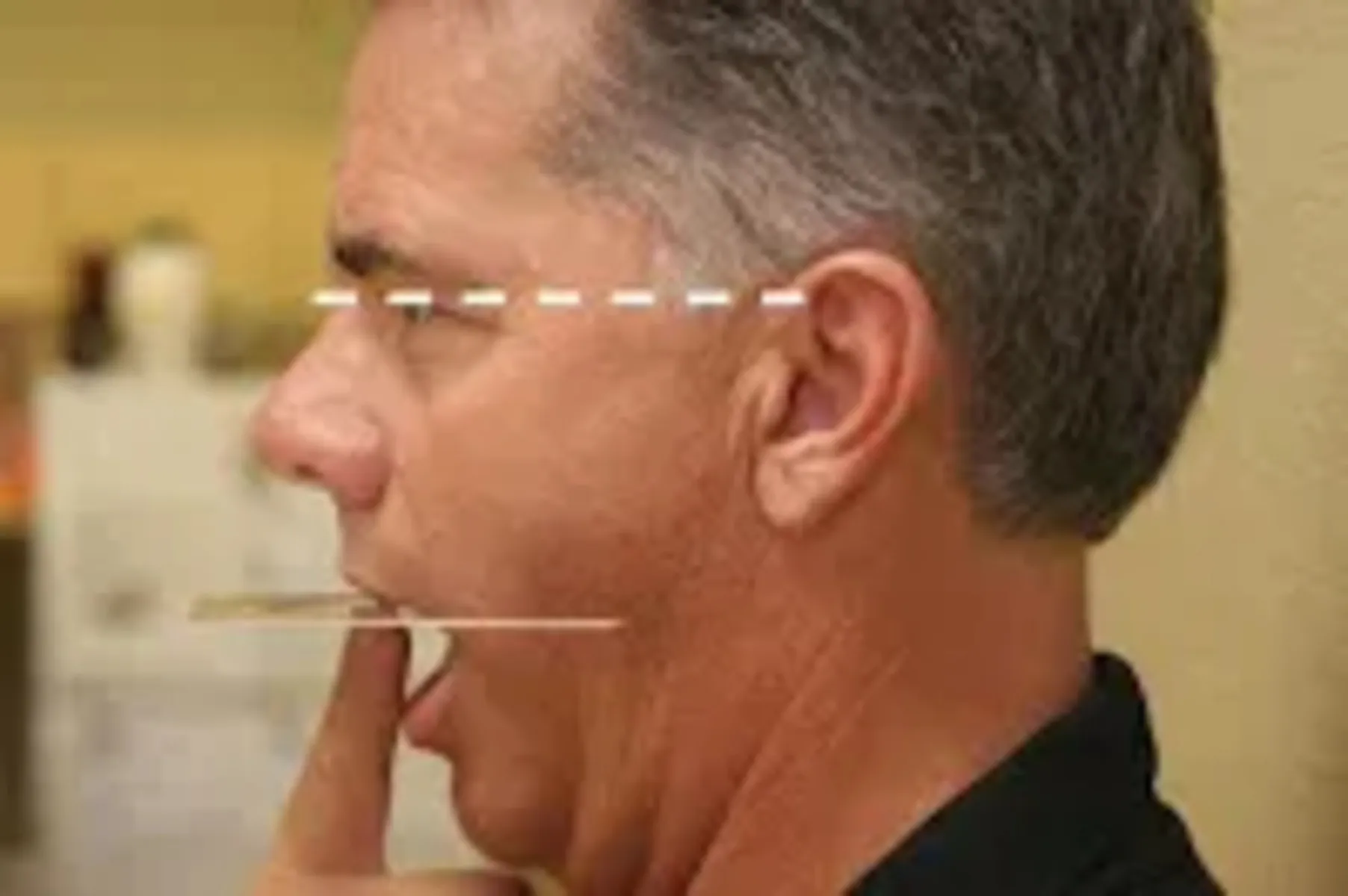 Buy GI Fox Plane Plasti Online | Shop Dental Tools on Dentalkart