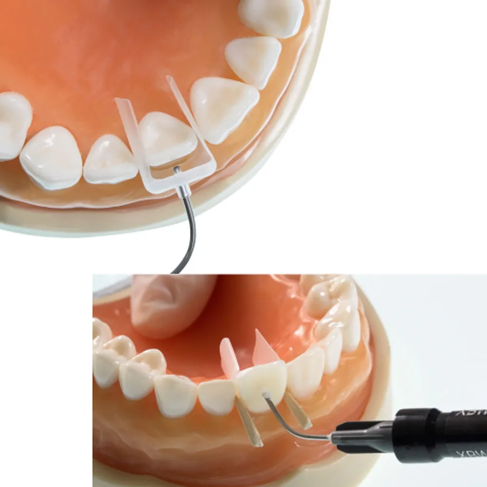 Younique IVeneer Injectable Matrix System