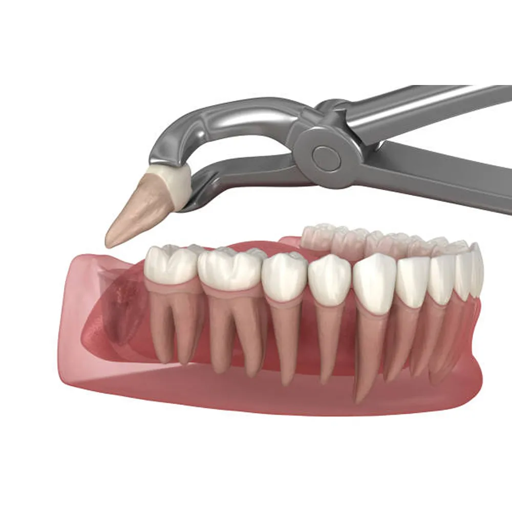 GDC Extraction Forcep Lower Third Molars - 79 Standard (FX79S) | Dentalkart