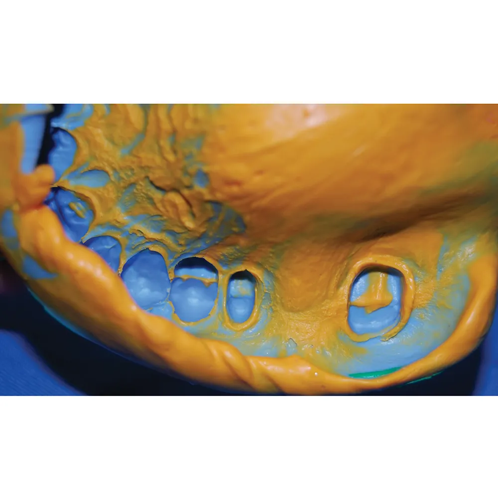 GC Flexceed Putty And Kit :- Buy Rubber Base Impression Material At ...