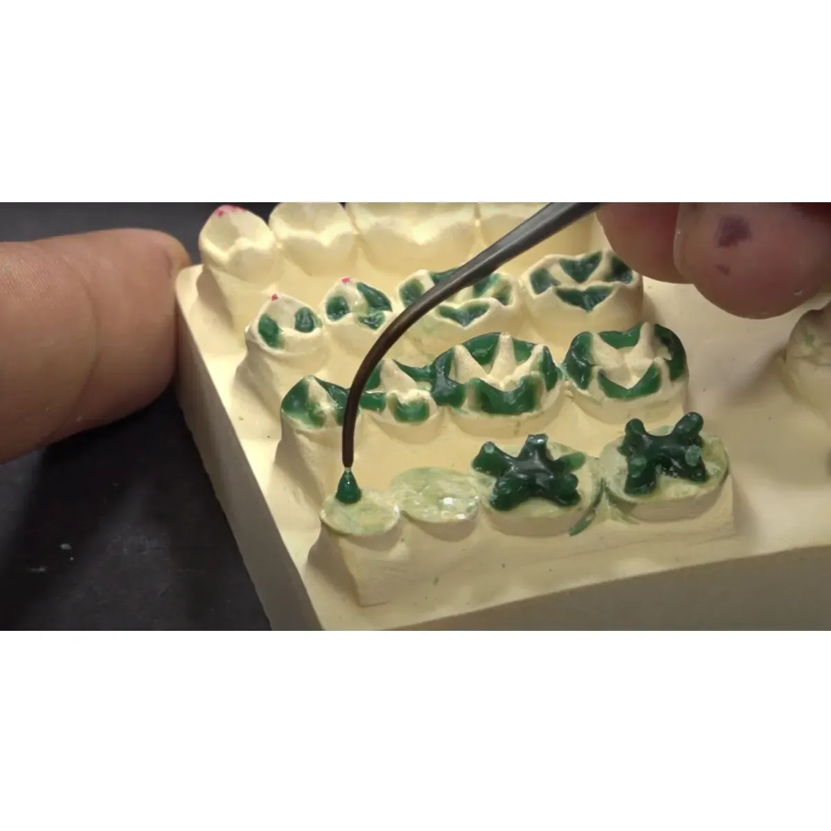 API PKT Instruments Set of 5 Online at Best Price | Dentalkart.com