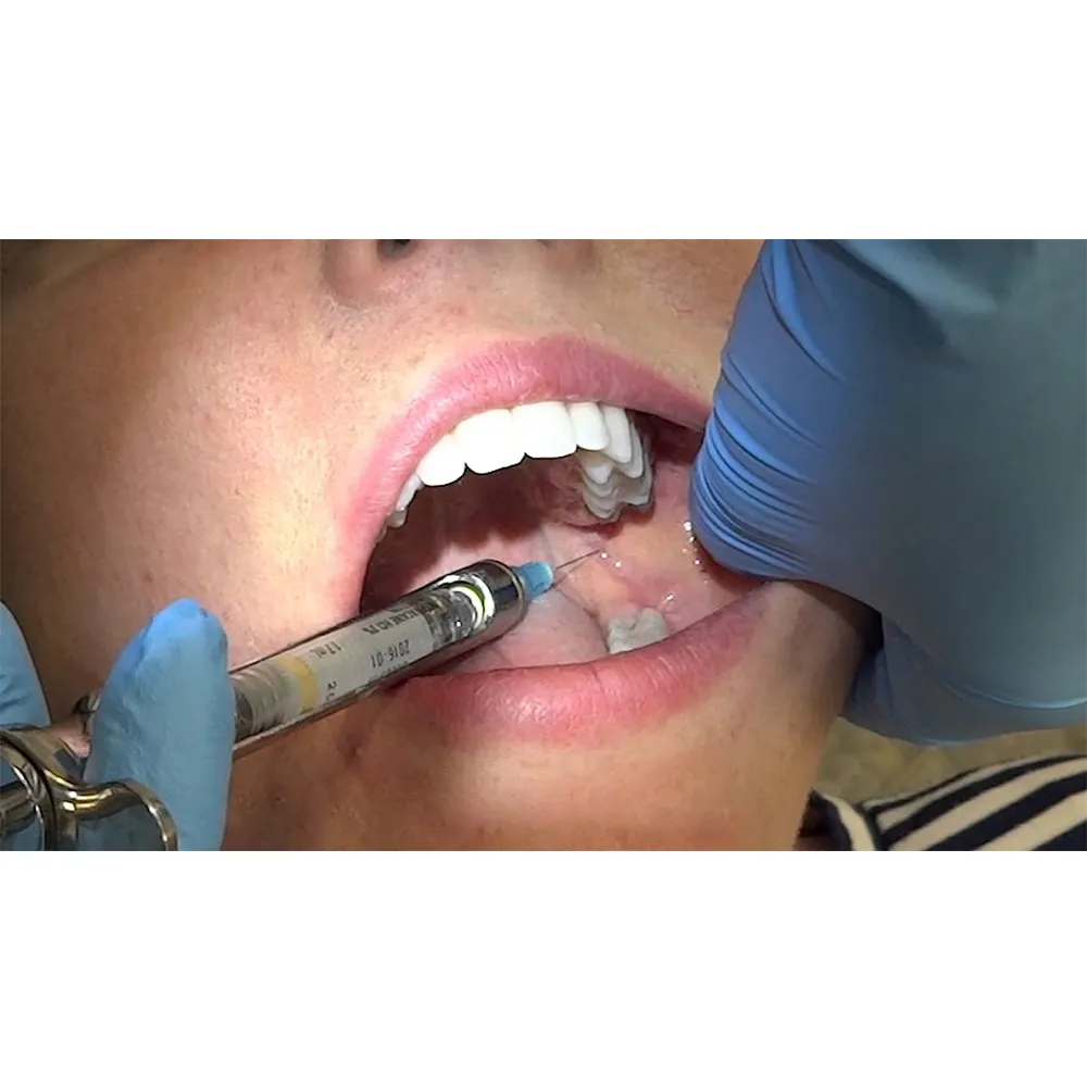 GDC Dental Syringe Aspirating With Ring (2.2ml) (SYRA2.2) Online at ...