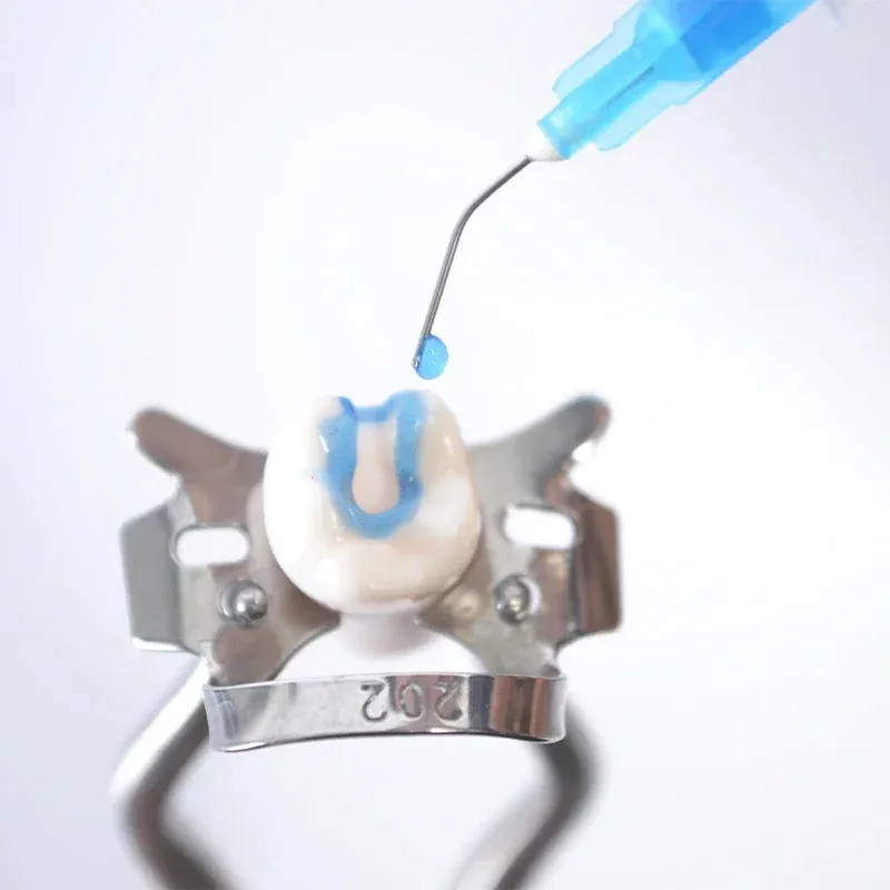 Anabond Eazetch Etchant Gel Online at Best Price | Dentalkart.com