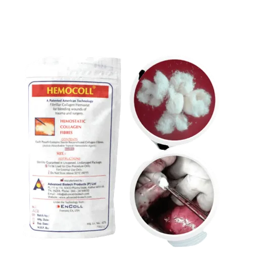 Advanced Biotech Hemocoll Online at Best Price | Dentalkart.com