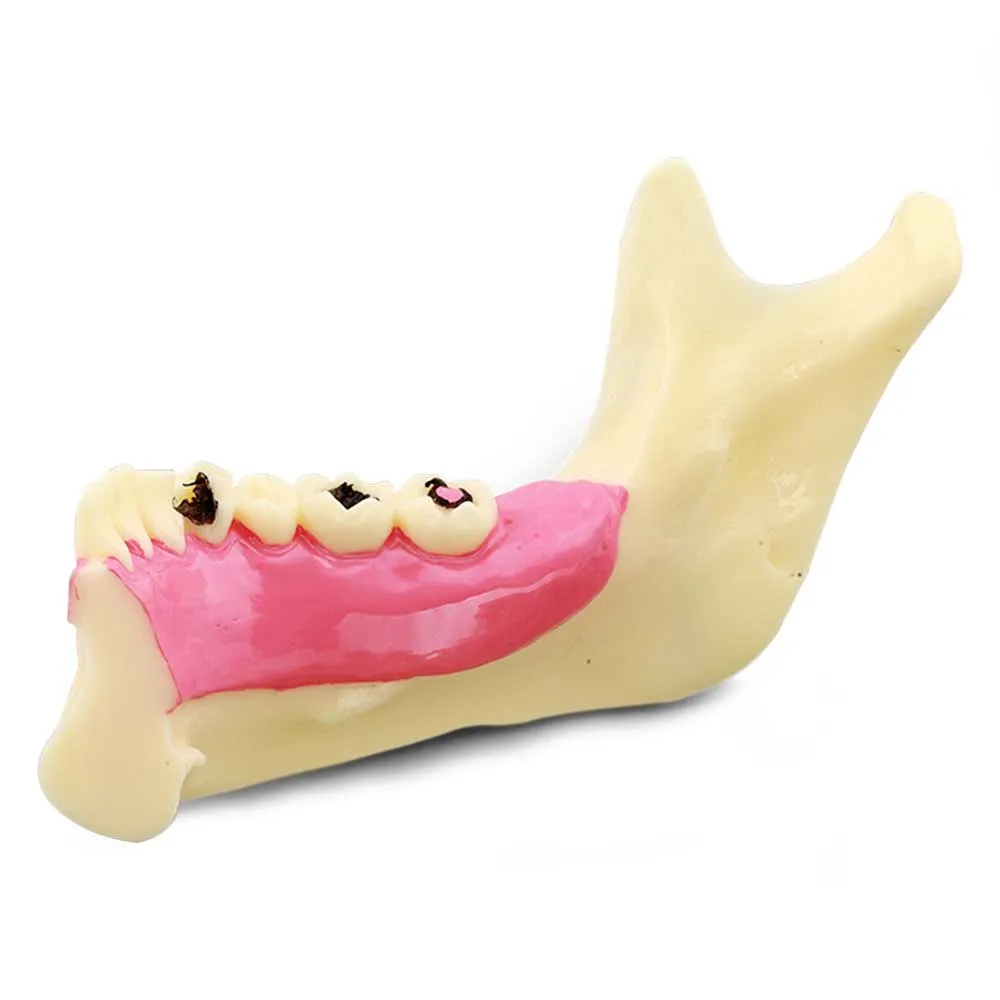 Buy iDENTical Mandible Model M4014 - Detailed Mandibular Bone Anatomy ...
