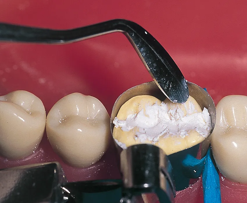 GDC Conservative Kit - Buy 19-Piece Dental Instruments Set Online ...