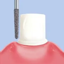 Buy Mani Diamond Burs Online - Quality & Precision for Dental Procedures