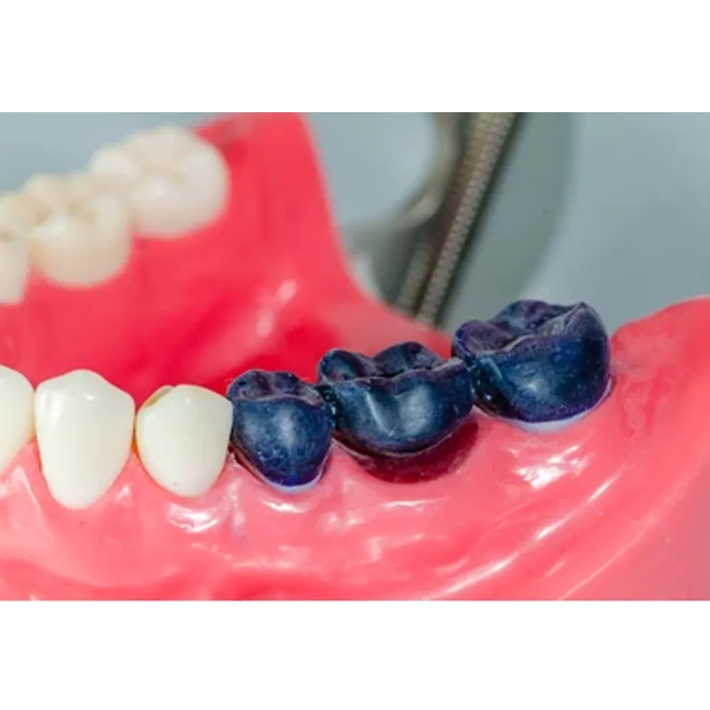 Maarc Inlay/Onlay Wax Sticks Online at Best Price | Dentalkart.com