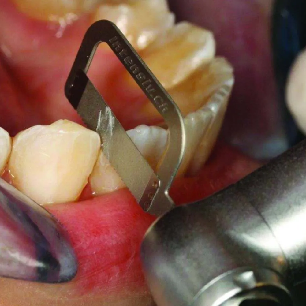 Waldent Orthodontic Inter-Proximal Reduction (IPR) Kit | Dentalkart