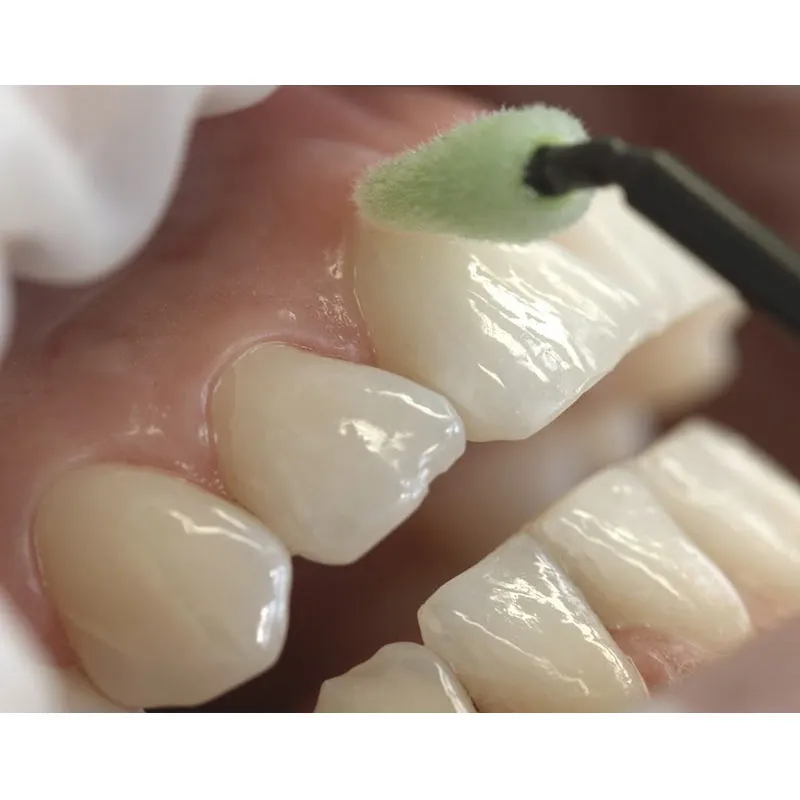 Shop Ivoclar Fluor Protector Gel and Varnish Online | DentalKart