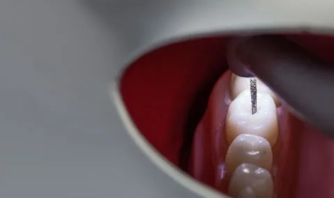 Waldent LED Airotor Handpiece And Cartridge | Dentalkart