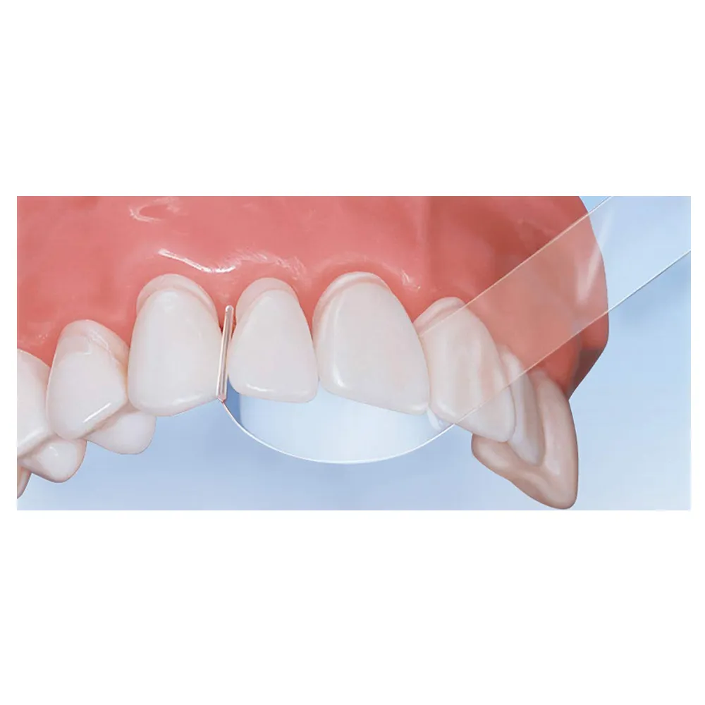 Buy High-Quality Indian Matrix Mylar Strips - Smooth and strong.