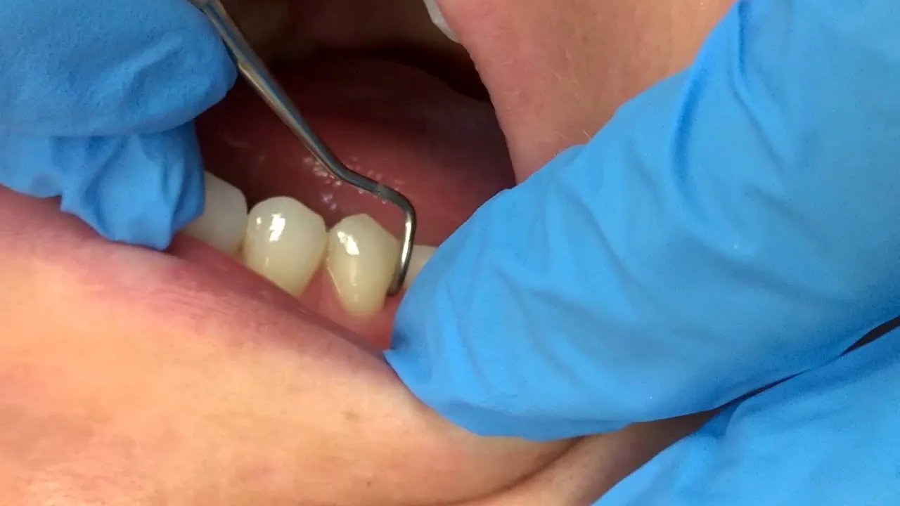 GDC Conservative Kit - Buy 19-Piece Dental Instruments Set Online ...