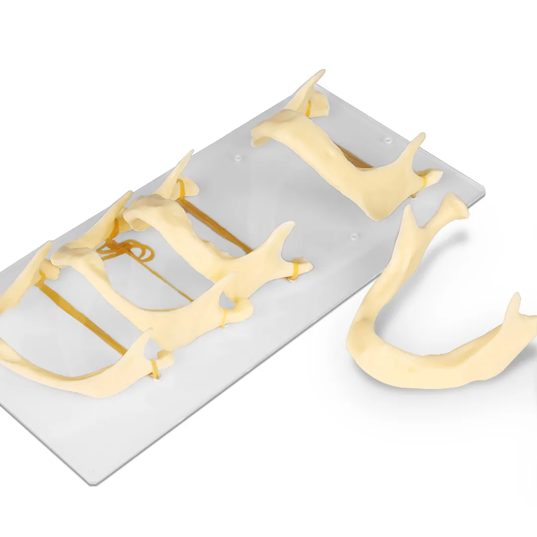 iDENTical Upper & Lower Jaw Development Models | Maxilla & Mandible ...