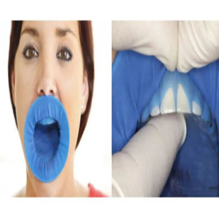 Buy Ivoclar Optradam Plus Online at Best Price | Dentalkart.com