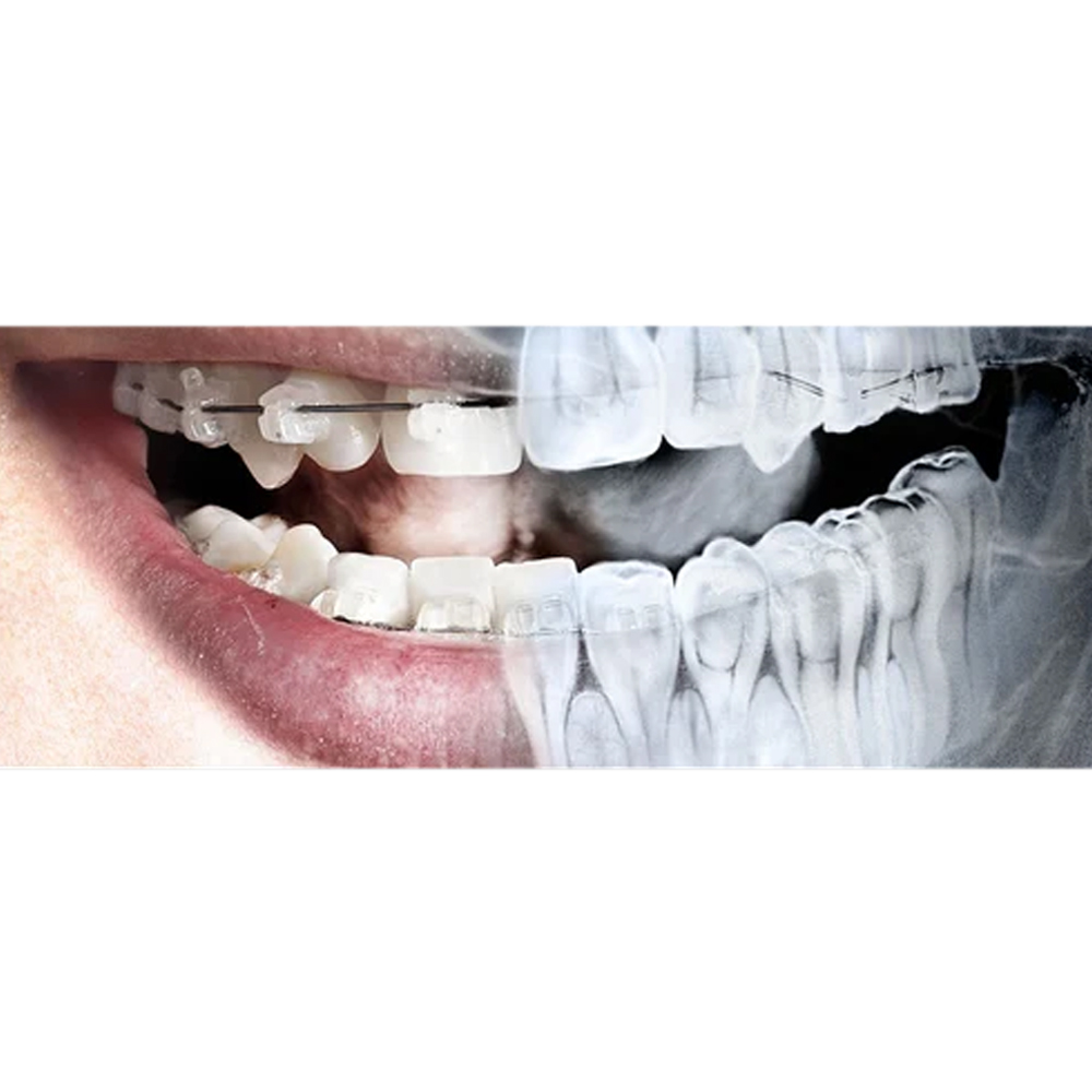 Medi Study Go Oral Medicine Mind Maps And Radiology Notes