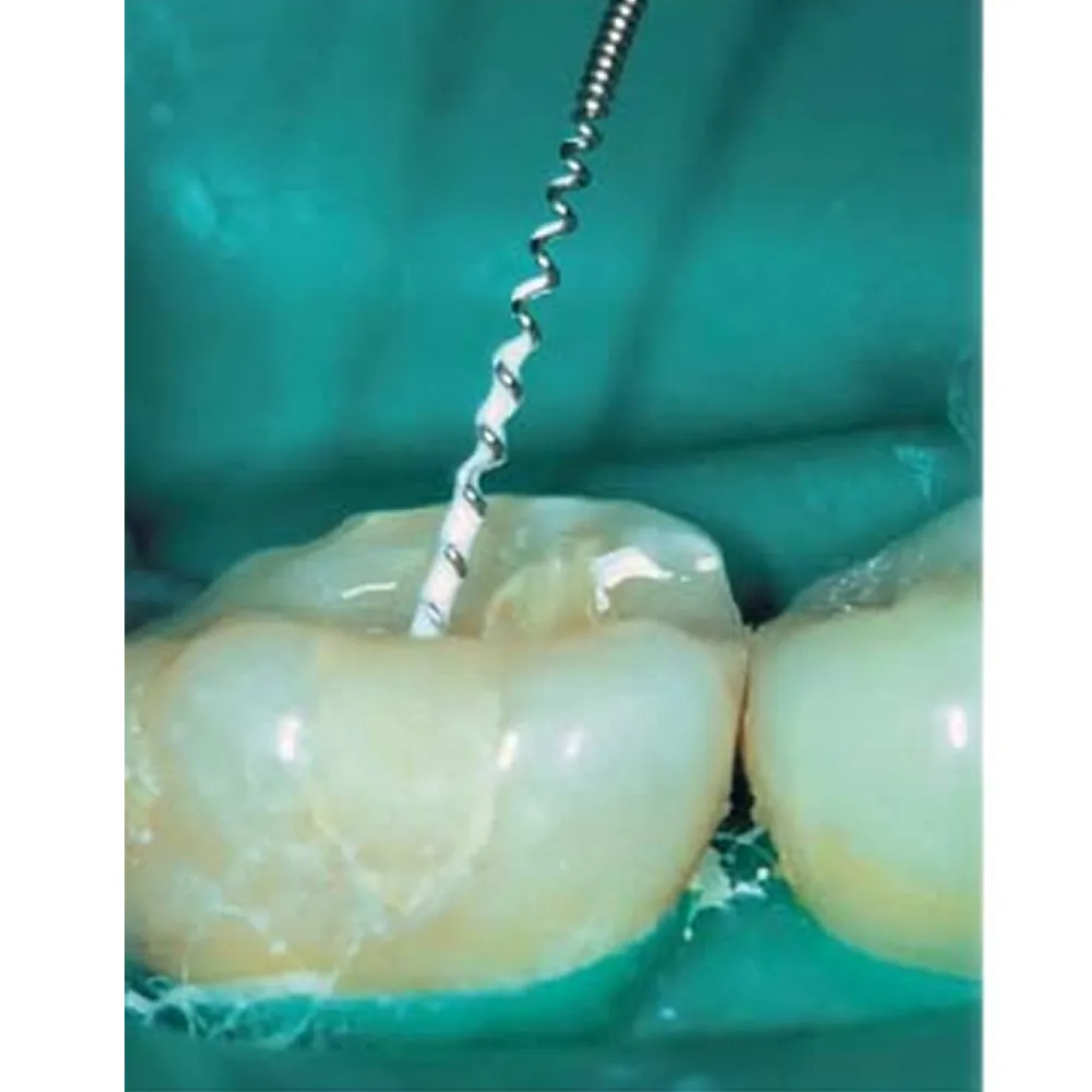 Waldent Paste Carrier (Lentulo Spiral) 21mm (Pack of 4) | Dentalkart