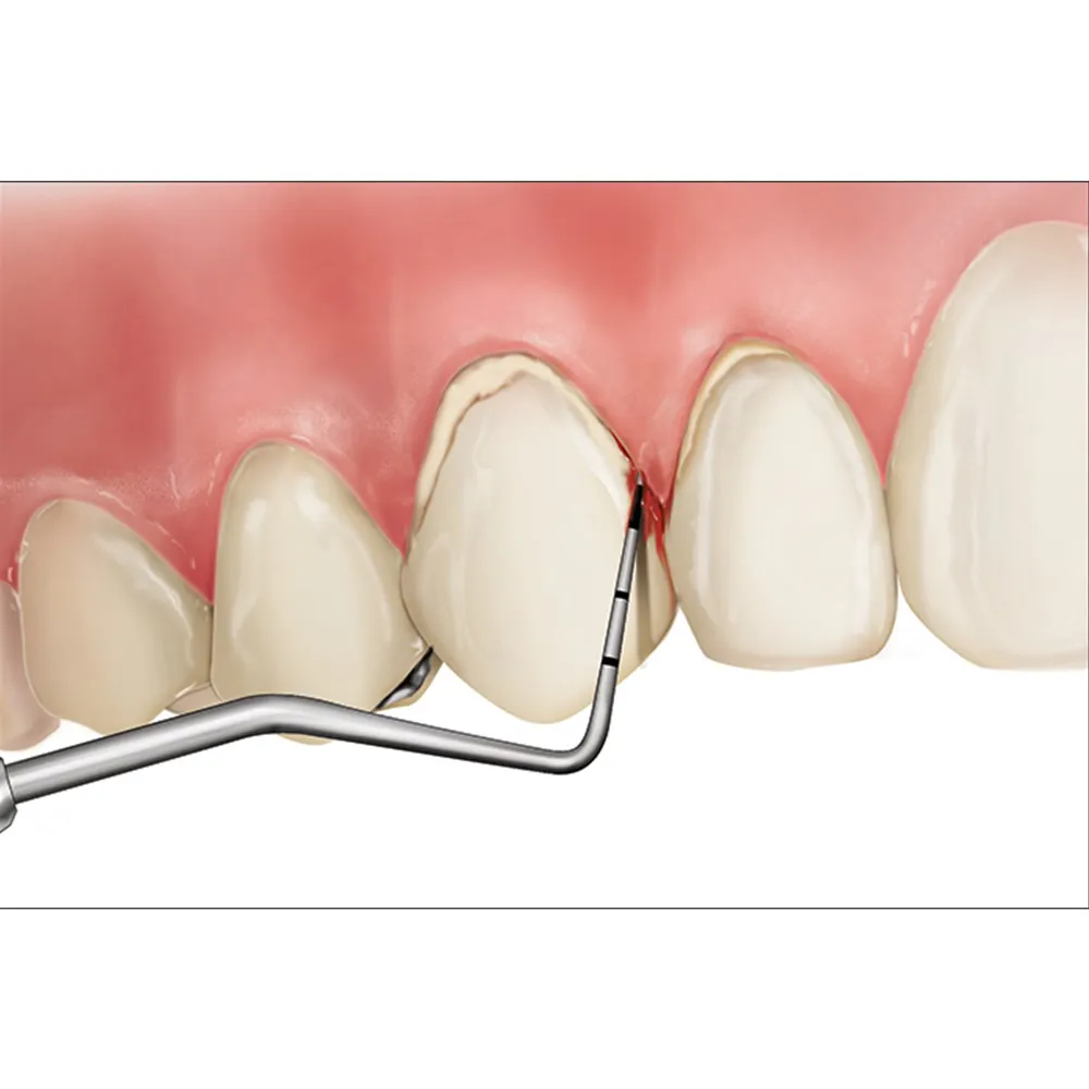 GDC Single End Probes Screening Probe (Who Probe) #6 (Pcp11.5b) Online ...