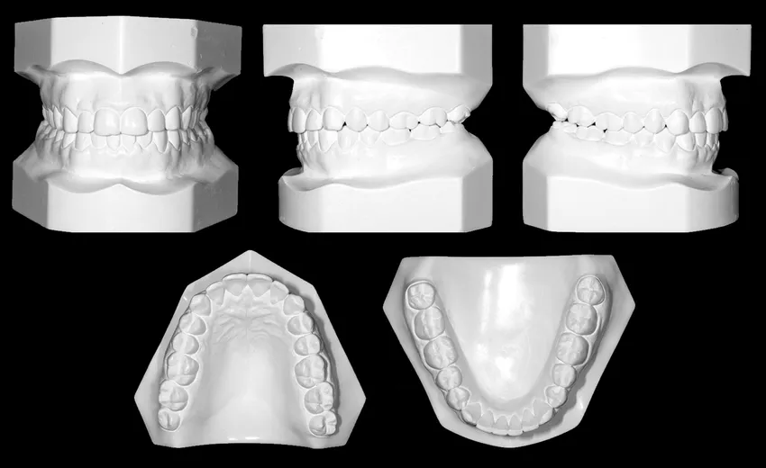 Kalabhai Orthokal - 3 Kg