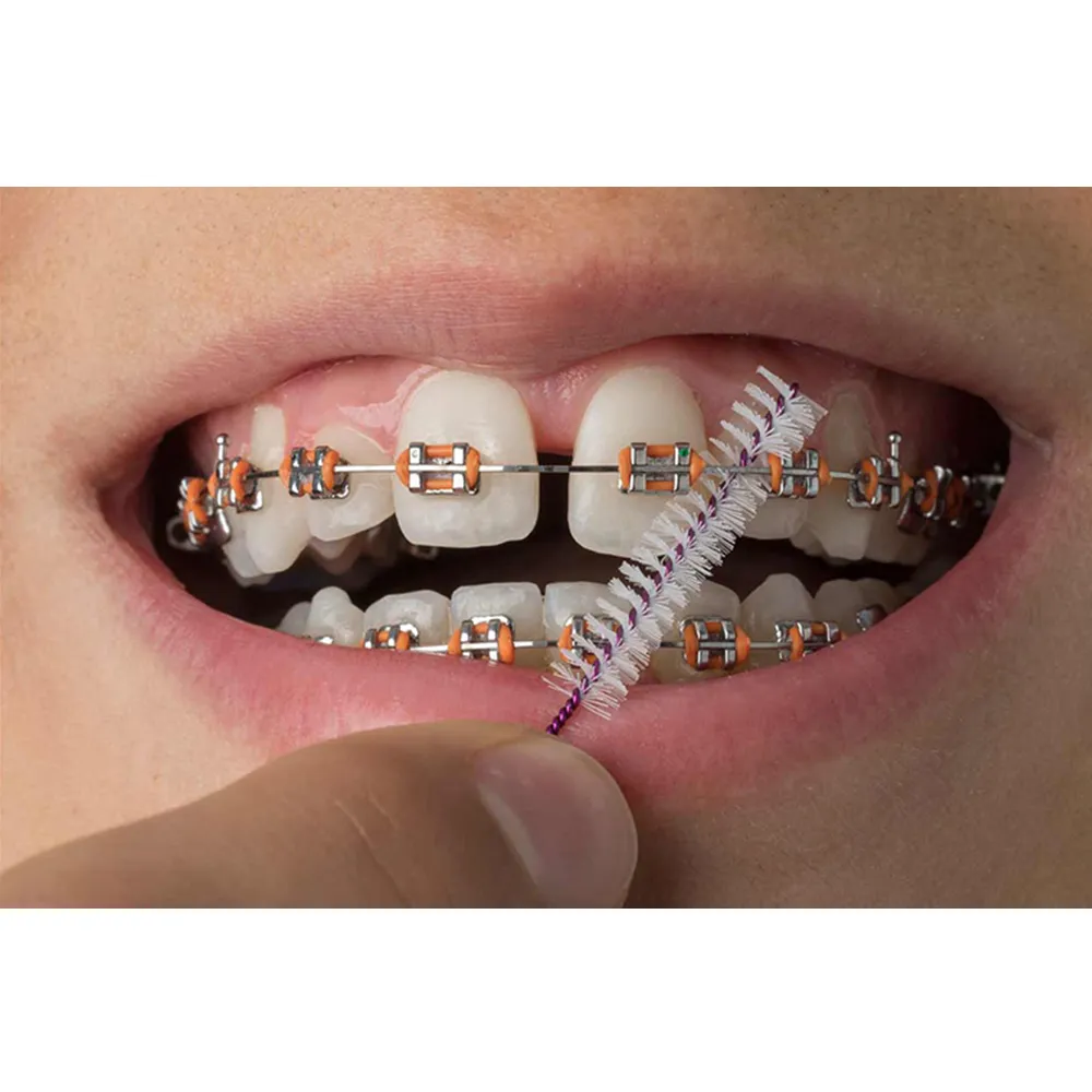 Buy D-Tech Precimax MIM MBT Prescription Brackets Online At Best Price ...