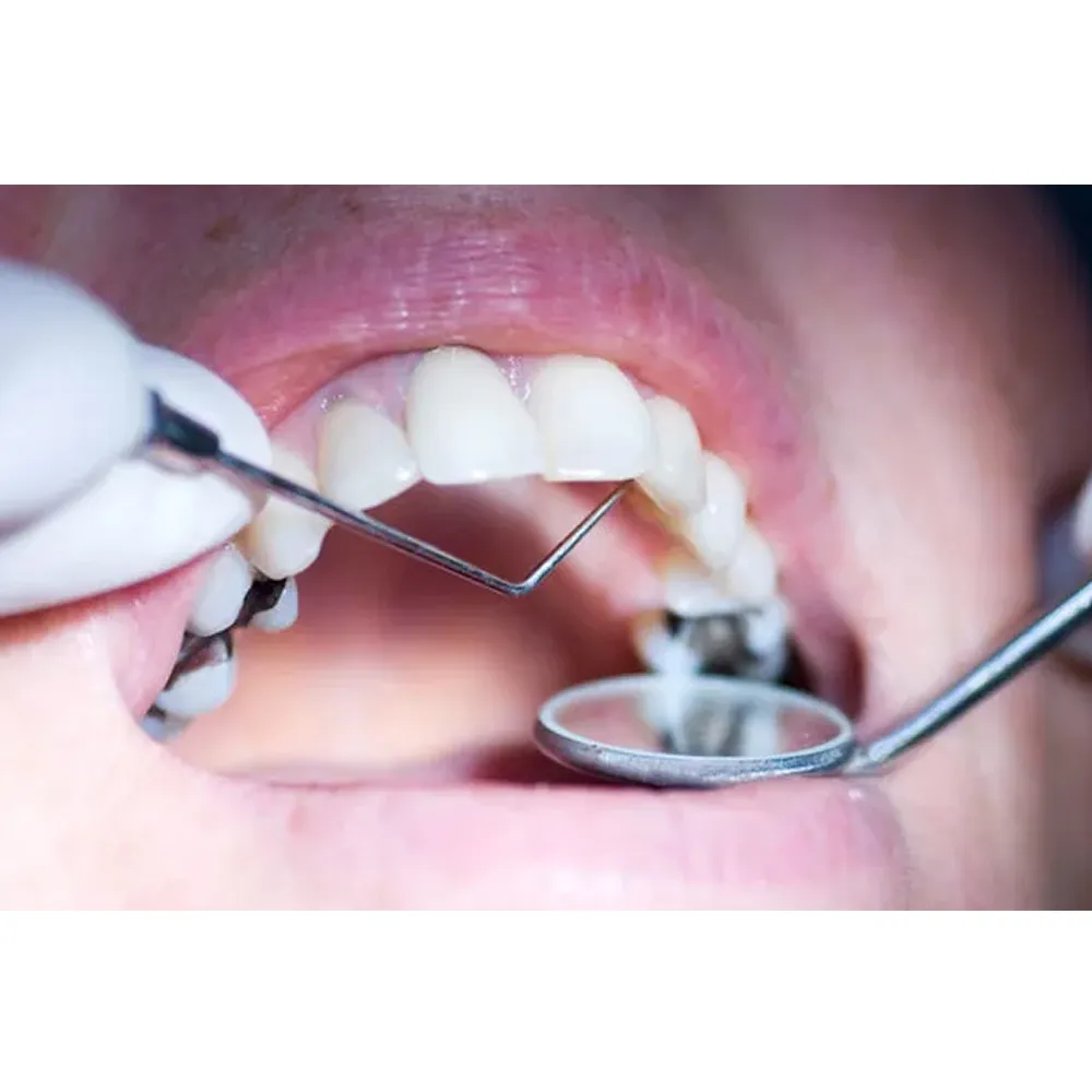 GDC Single End Probe -1 (Exs6l) Online at Best Price | Dentalkart.com