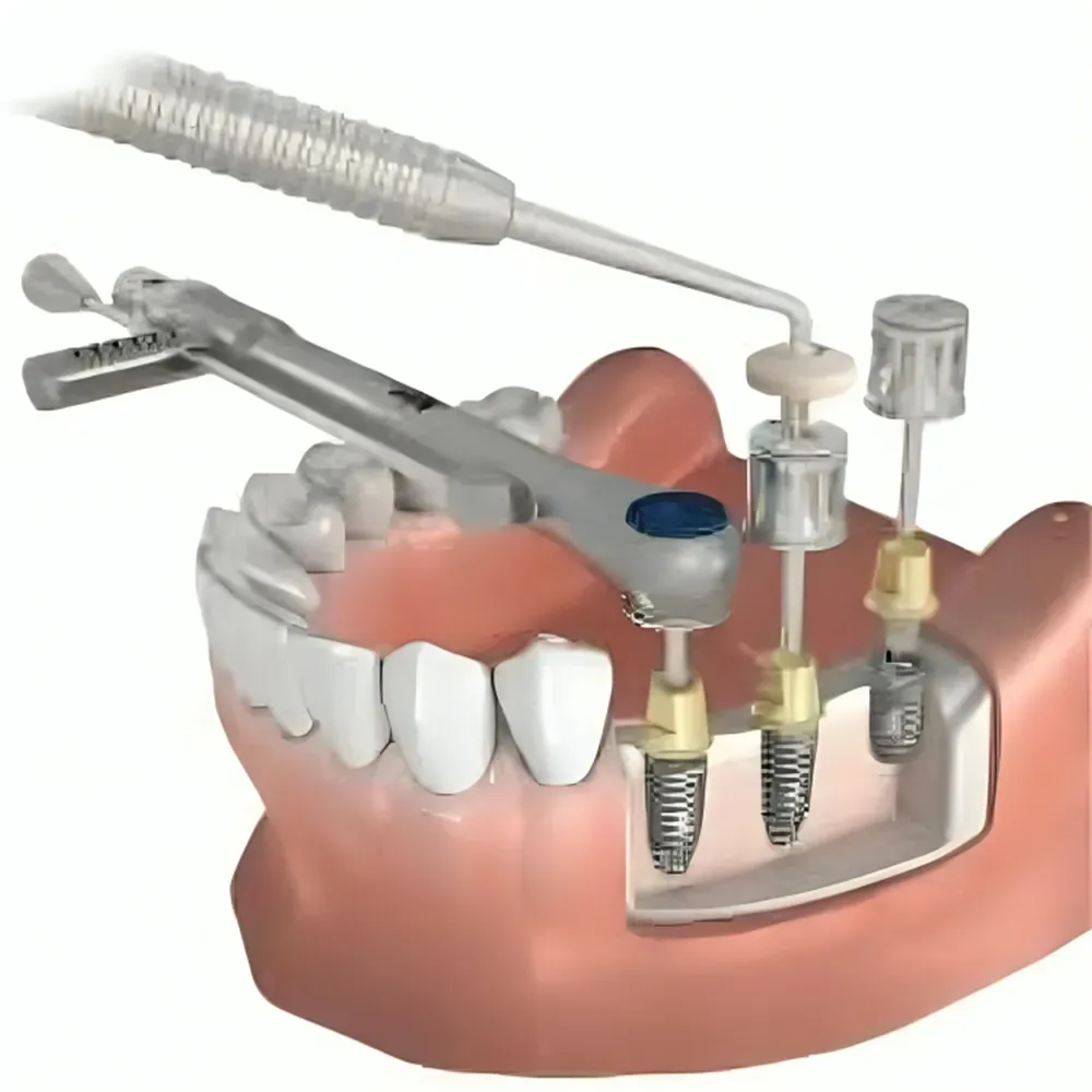 Buy Dentalplant Implant Hex Drivers Online at Best Price | Dentalkart.com