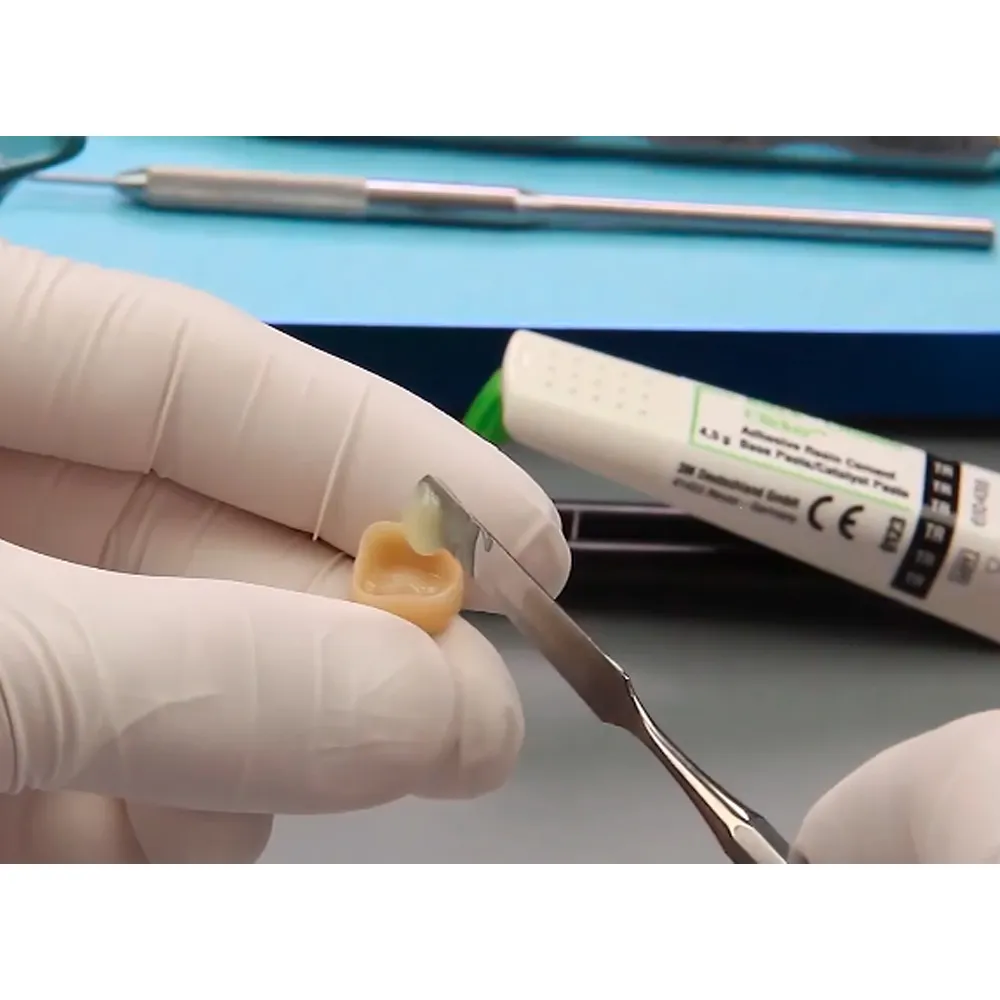 Relyx Luting Cement: Buy 3m Espe Relyx Ultimate Adhesive Resin Cement ...