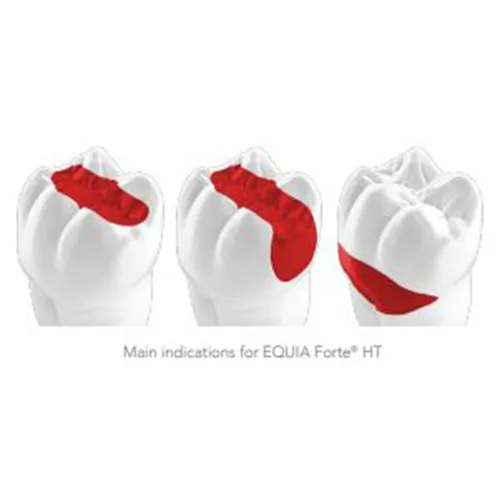 Buy GC Equia Forte HT Capsule Online | Dental Bulk-Fill Solution