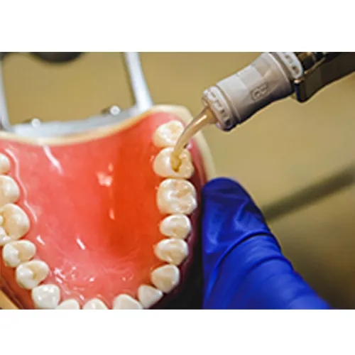 Buy GC Equia Forte HT Capsule Online | Dental Bulk-Fill Solution