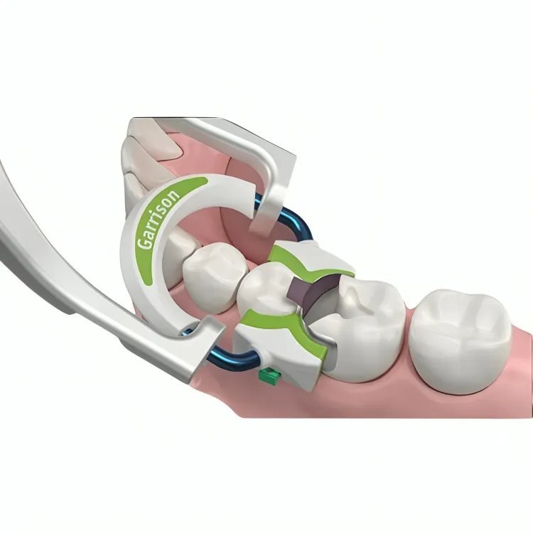 Garrison Dental Strata-G Matrix Rings