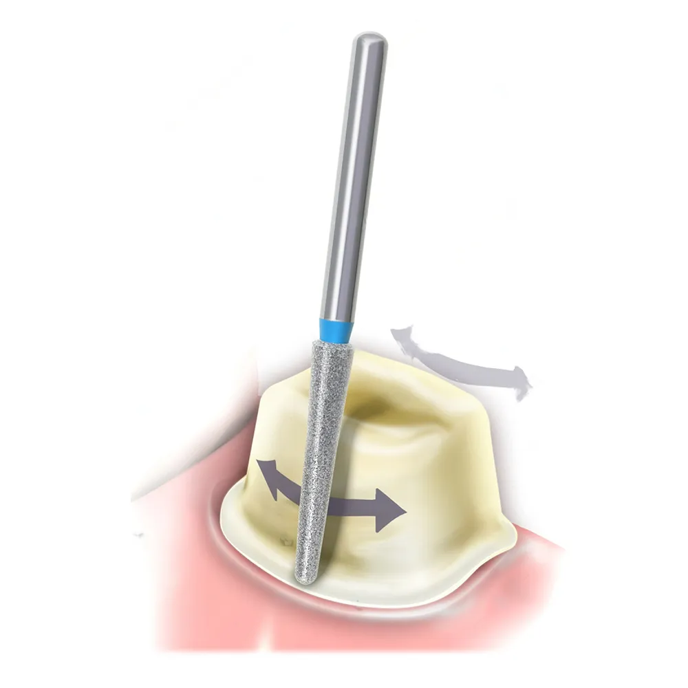 NewDiamond Rounded Shoulder Diamond Bur -RS (Pack Of 3) | DentalKart