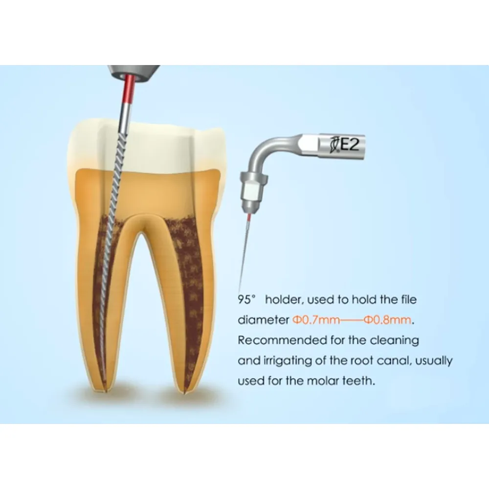 Woodpecker Endodontic Scaler Tips for UDS & EMS Scalers