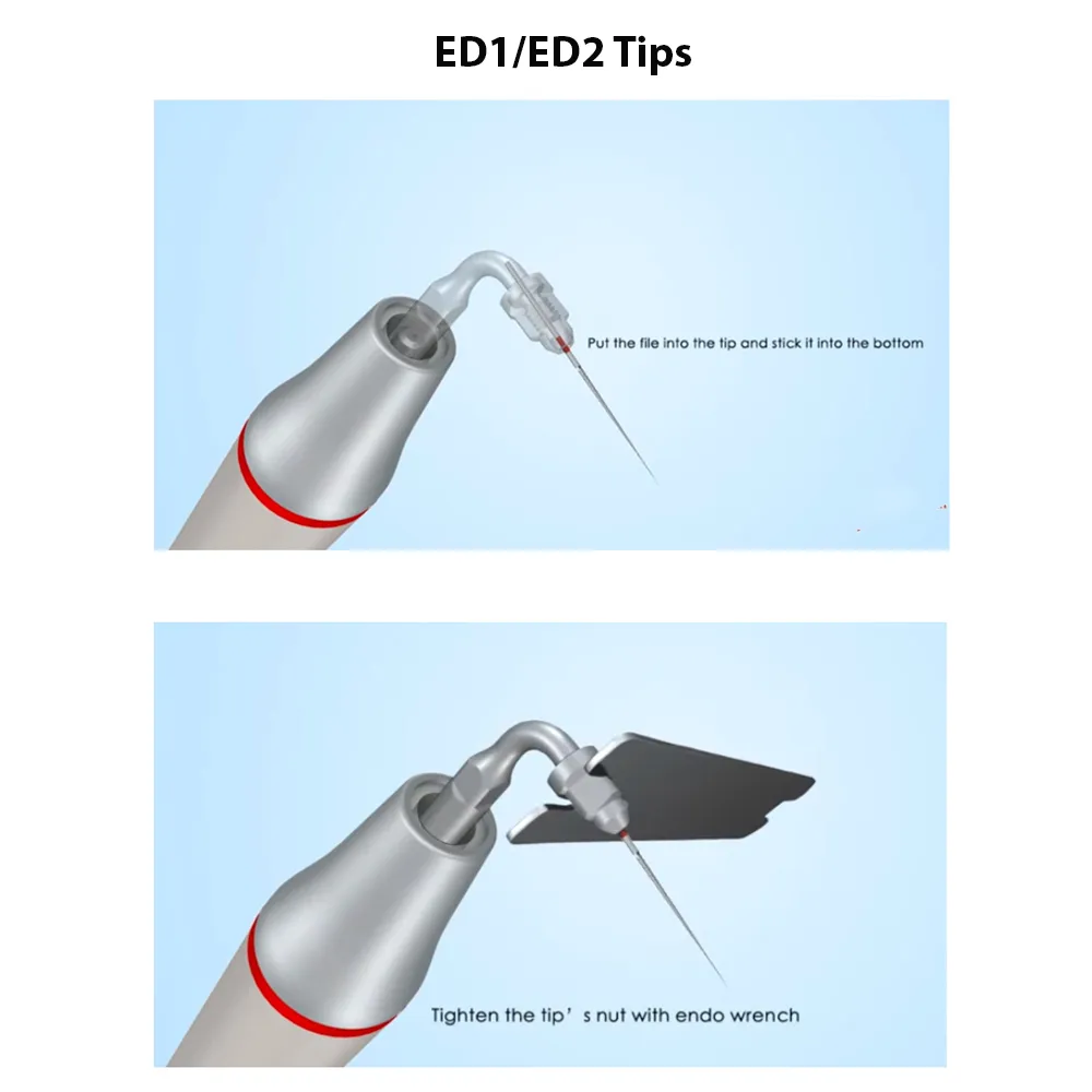 Woodpecker Endodontic Scaler Tips for DTE & Satelec Scalers