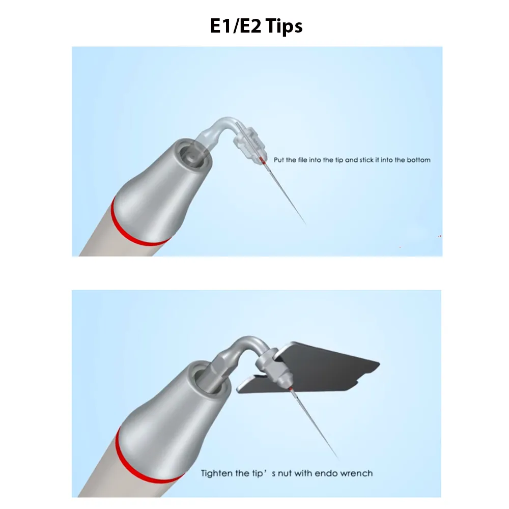 Buy Woodpecker Scaler Tips ED1 for DTE & Satelec Scalers | Dentalkart