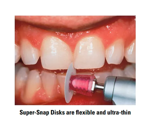 Shofu Super Snap Mini Kit CA Online at Best Price | Dentalkart.com