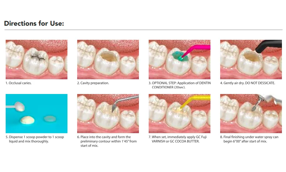 Buy GC Gold Label Hybrid - High Strength, Aesthetics | DentalKart