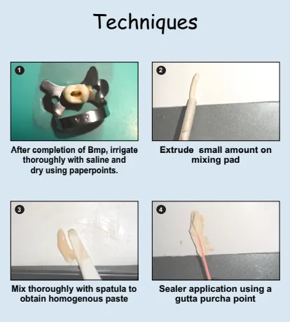 Buy Prevest Zical Automix Online at Best Price | Dentalkart.com