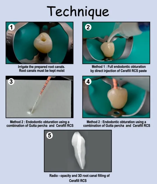 Prevest Cerafill : Buy Prevest Cerafill RCS - 1 x 1.2 gm Online at Best ...