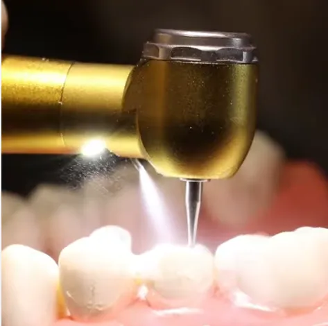 Gold LED Special Edition Airotor W-154: Buy Luxurious Airotor online at ...