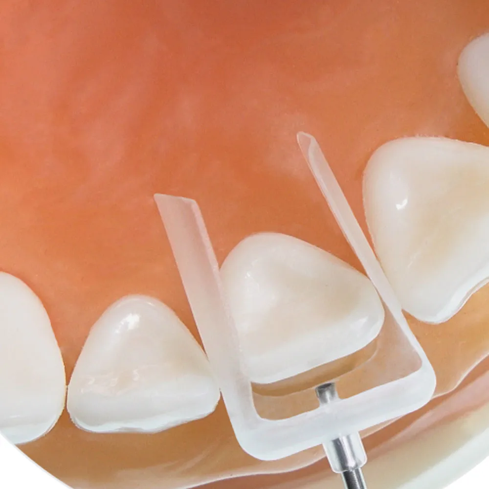 Younique IVeneer Injectable Matrix System