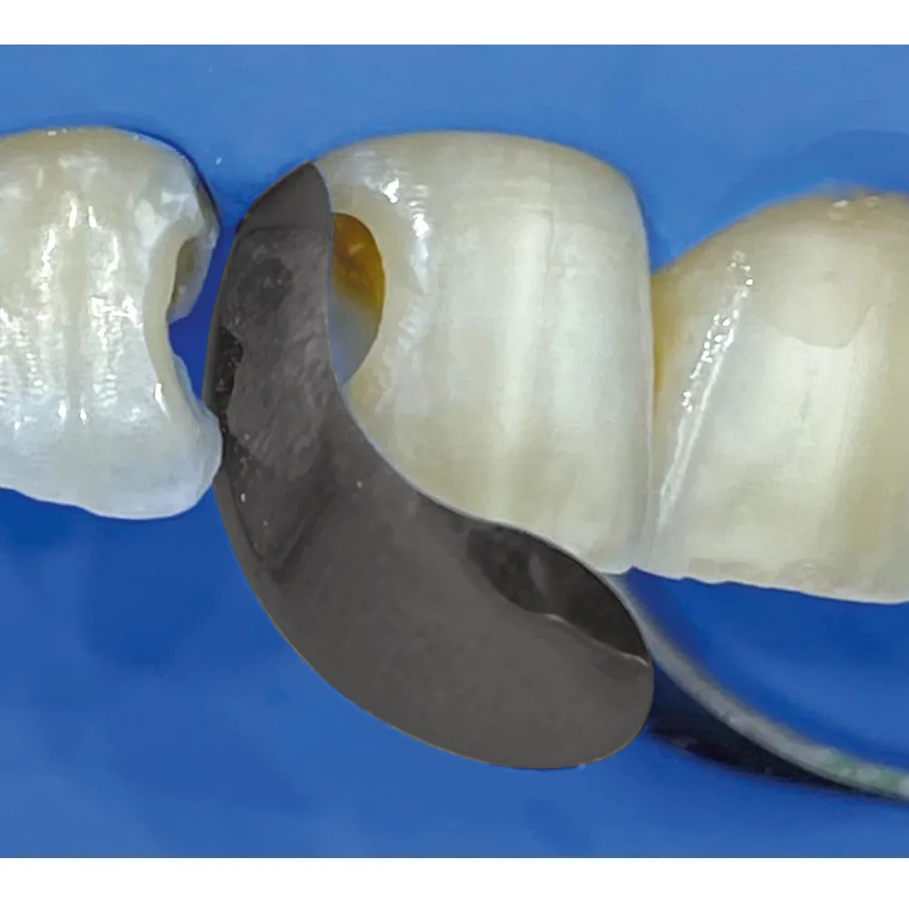 Polydentia Quickmat Sectional Matrices