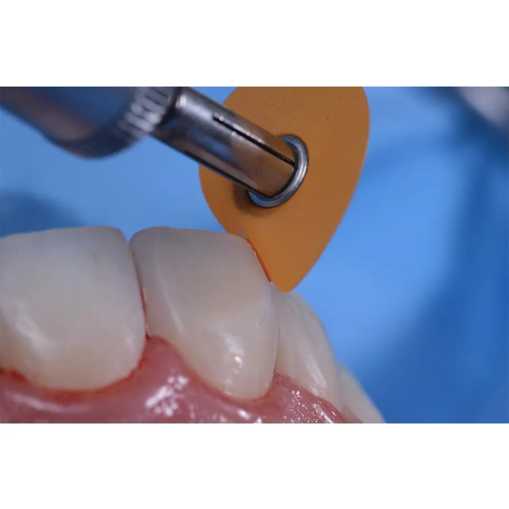 Buy 3M ESPE Sof-Lex Polishing Discs Kit & Accessories- Dentalkart