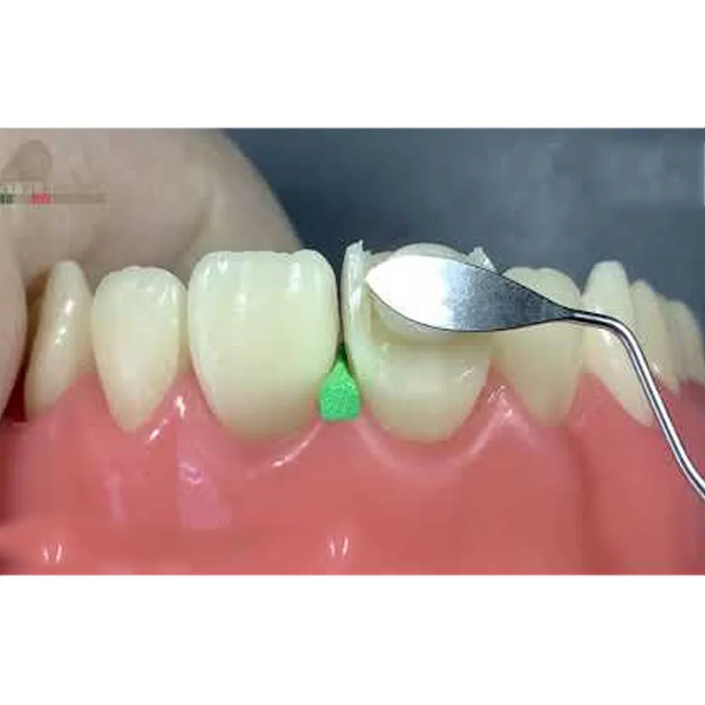 GDC Restore Instrument - Applica