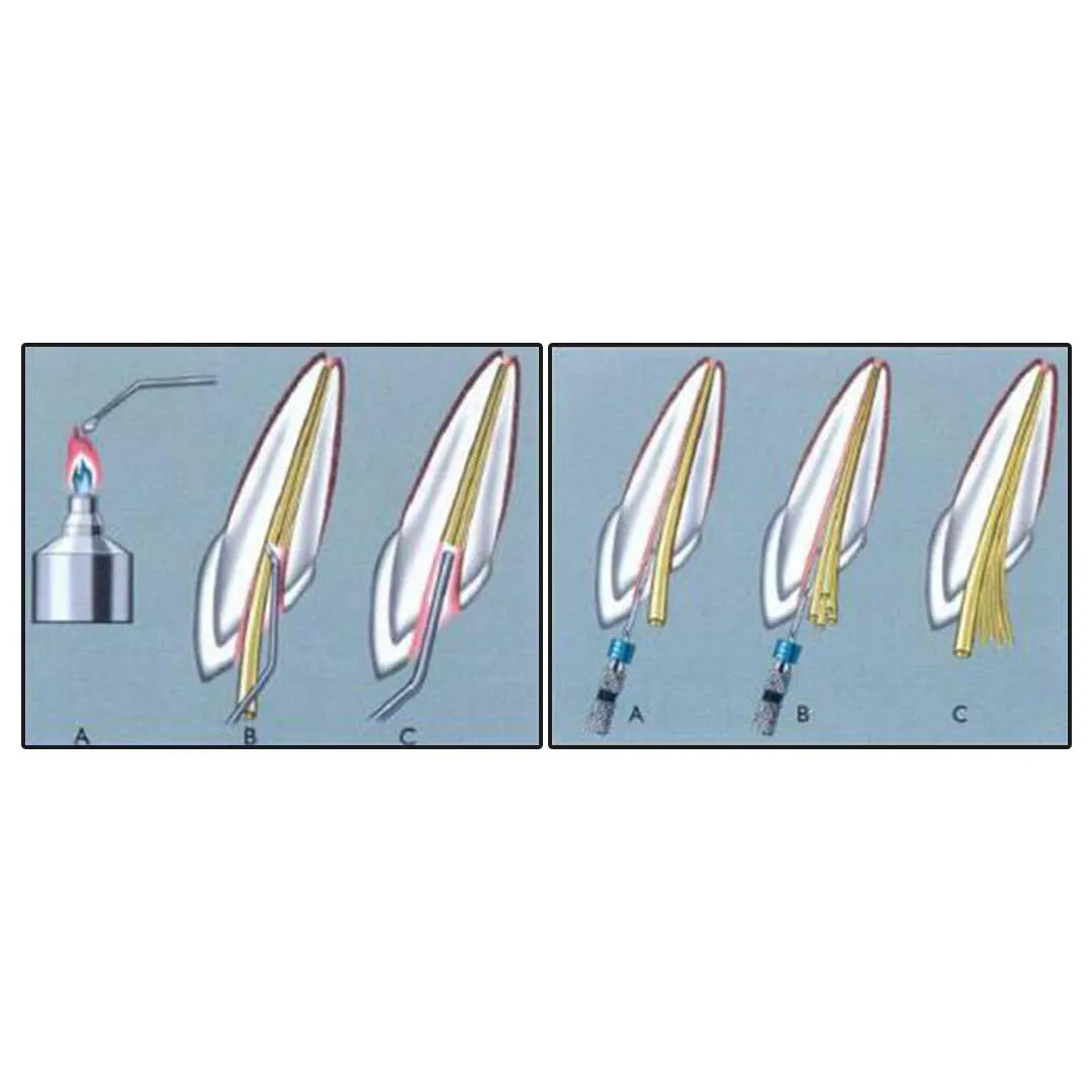 Buy Waldent Root Canal Spreaders Set of 6 (K15/4) Online at Best Price ...