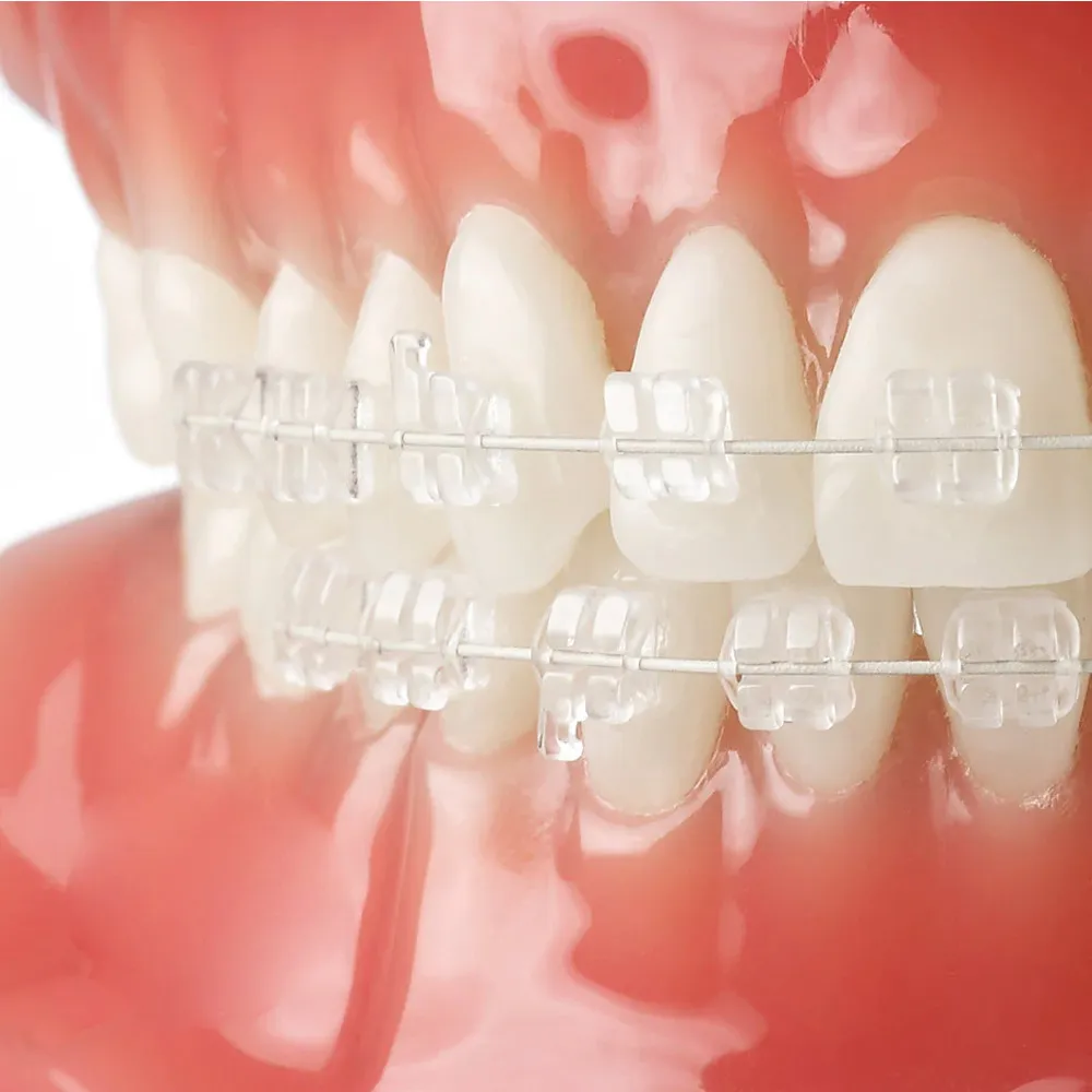 JJ Ortho Tooth Colored Stainless Steel Archwires - Round