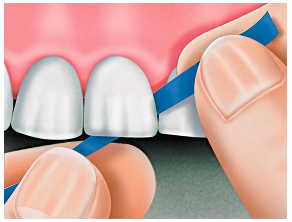 Buy Now Russia TOR VM Finishing Polishing Kit Online - DentalKart