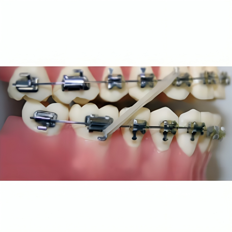 Buy U Ortho Bondable Buccal Tubes for 1st Molar MBT 0.022 Online ...