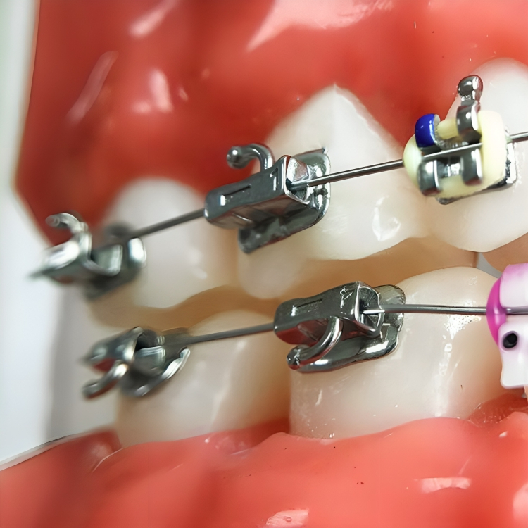 Buy U Ortho Bondable Buccal Tubes for 1st Molar MBT 0.022 Online ...