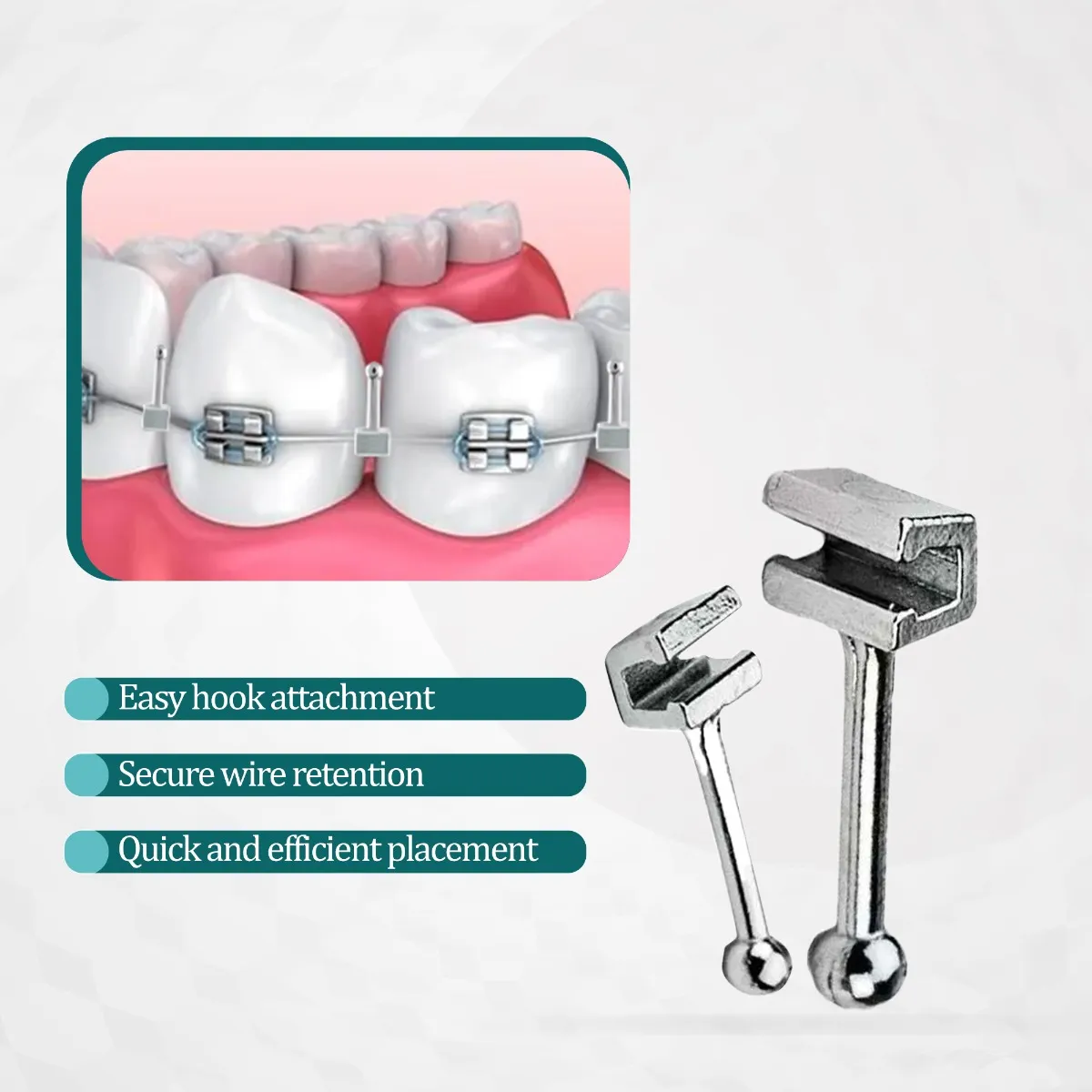 Buy U Ortho Crimpable Hook Long Online at Best Price | Dentalkart.com