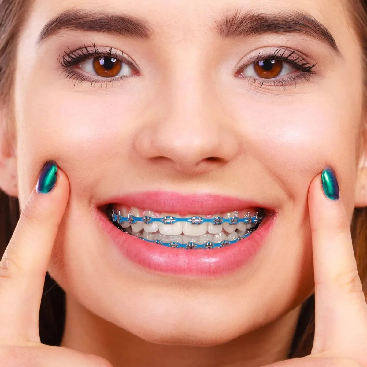 Buy U Ortho E-Chain (15 ft) - Continuous White Online at Best Price ...